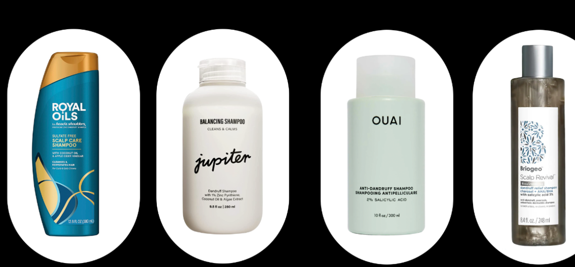 How To Get Rid Of Really Bad Dandruff | Treatments And Remedies